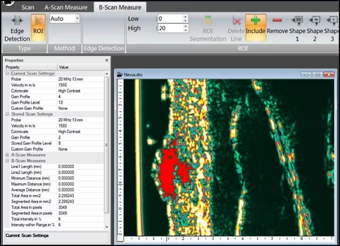 DermaScan de Cortex - Élite Láser