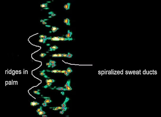DermaScan de Cortex - Élite Láser